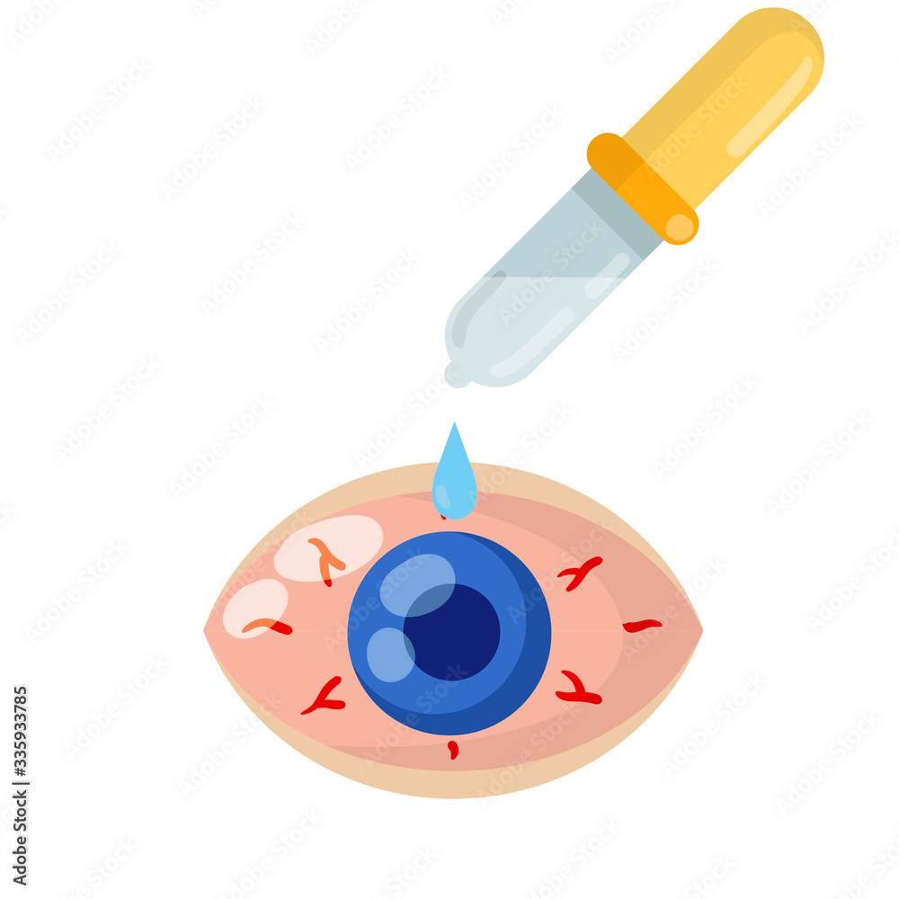 Pipette and eyedropper. Red eye disease. Medicine for blood vessels and ...