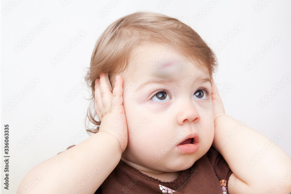 Hands of a child on his head with a big bump on his forehead. Baby ...