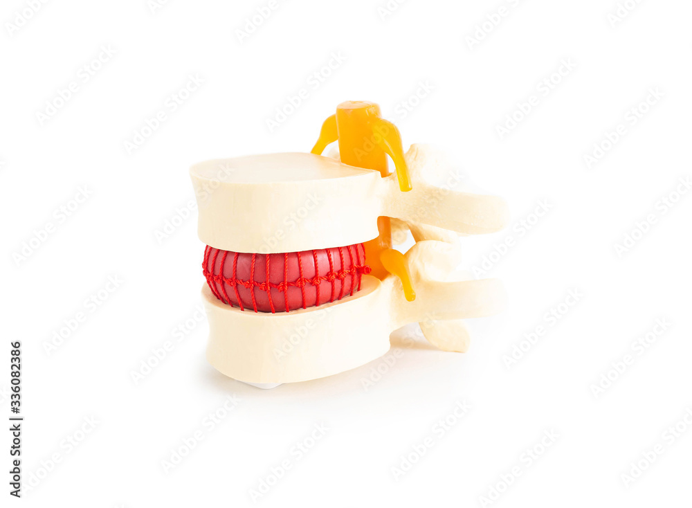 Model of the lumbar spine with intervertebral discs and vertebrae on a ...