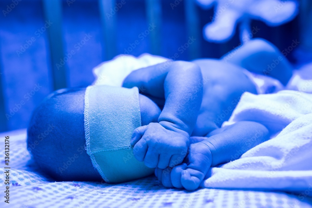 Newborn having a treatment for jaundice under ultraviolet light, Baby ...