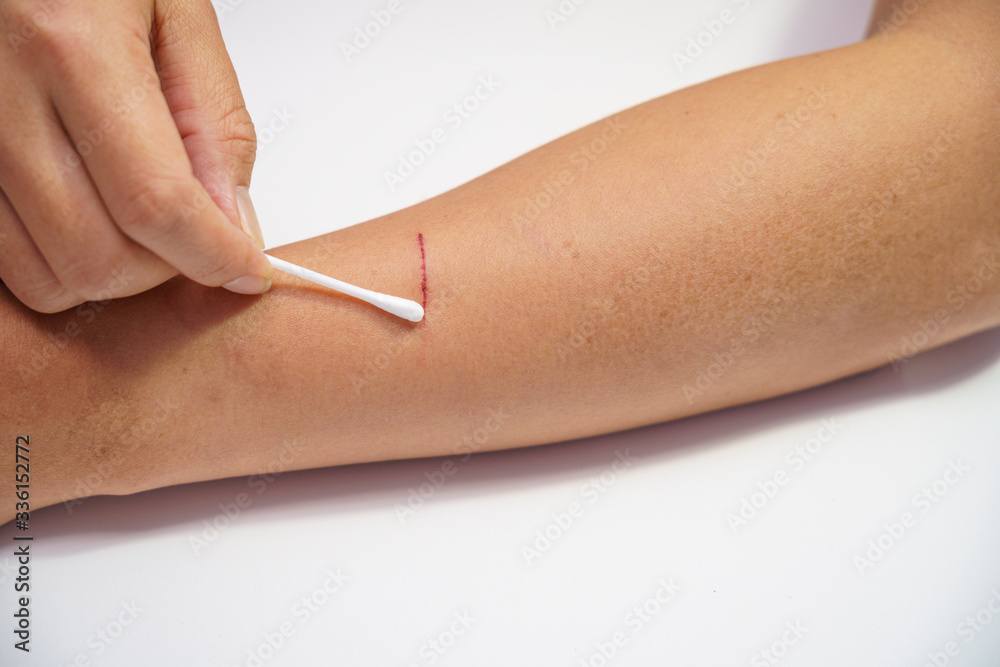 Close up Men's arms hand, upper limb or arm to the wounded blood and ...