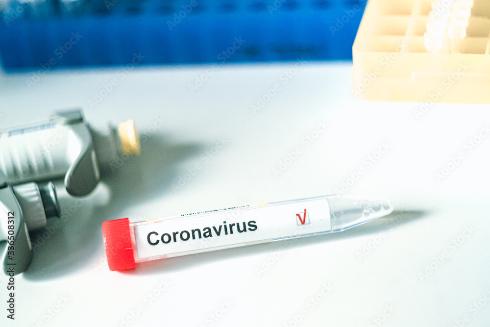 Coronavirus or COVID-19 test. test tube with coronavirus test label on ...