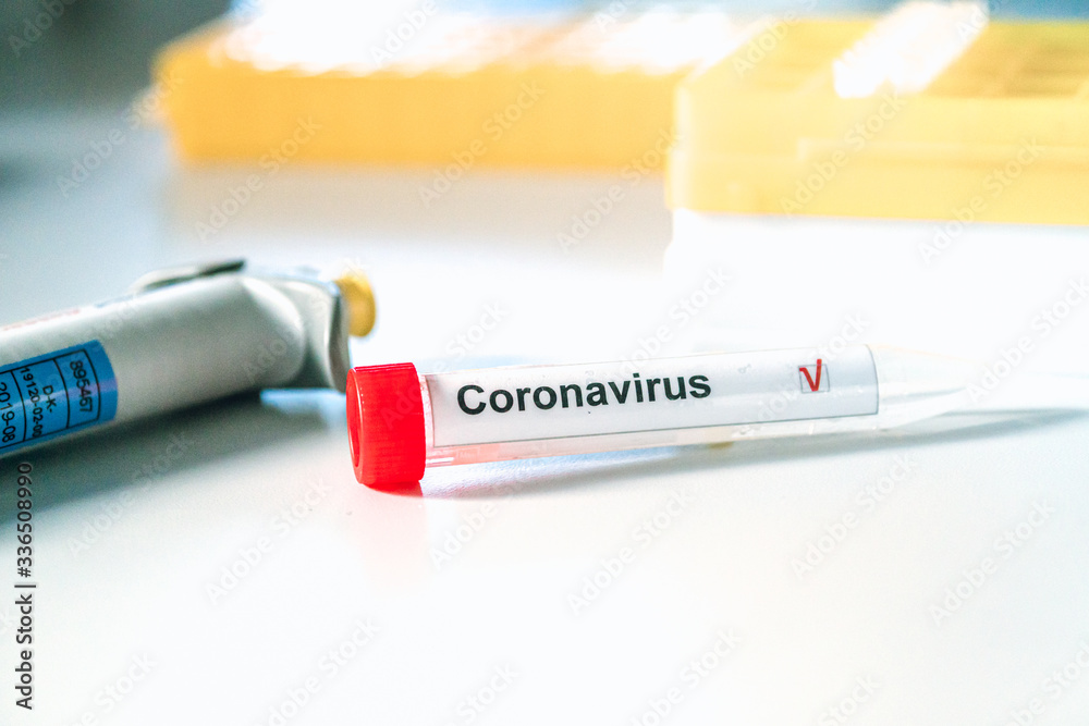 Coronavirus or COVID-19 test. test tube with coronavirus test label on ...
