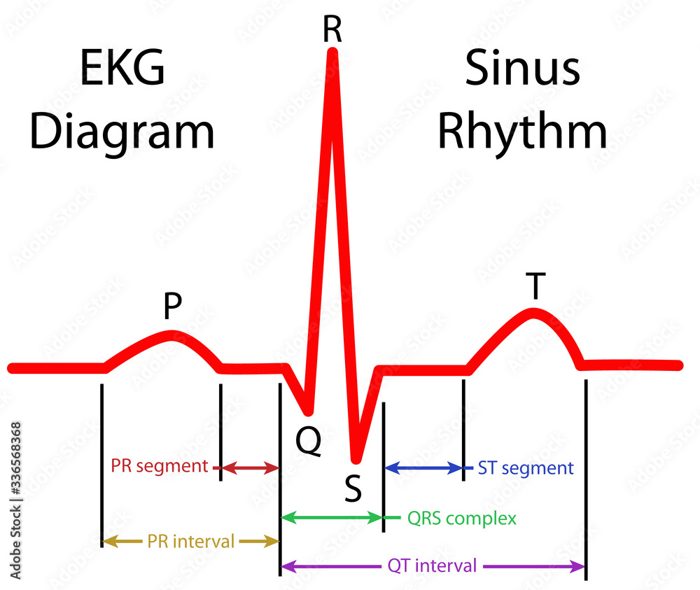 EKG Diagram Sinus Rhythm Stock Vector | Adobe Stock