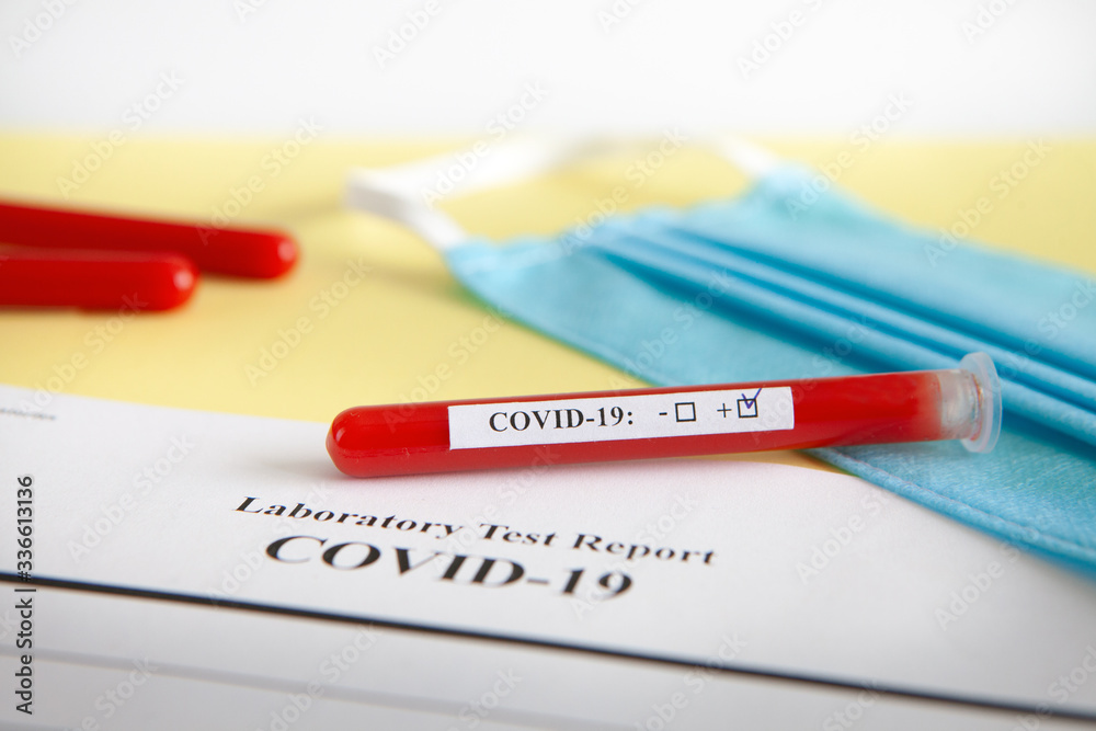 World coronavirus epidemic concept. Pandemic COVID-19, 2019-nKoV ...