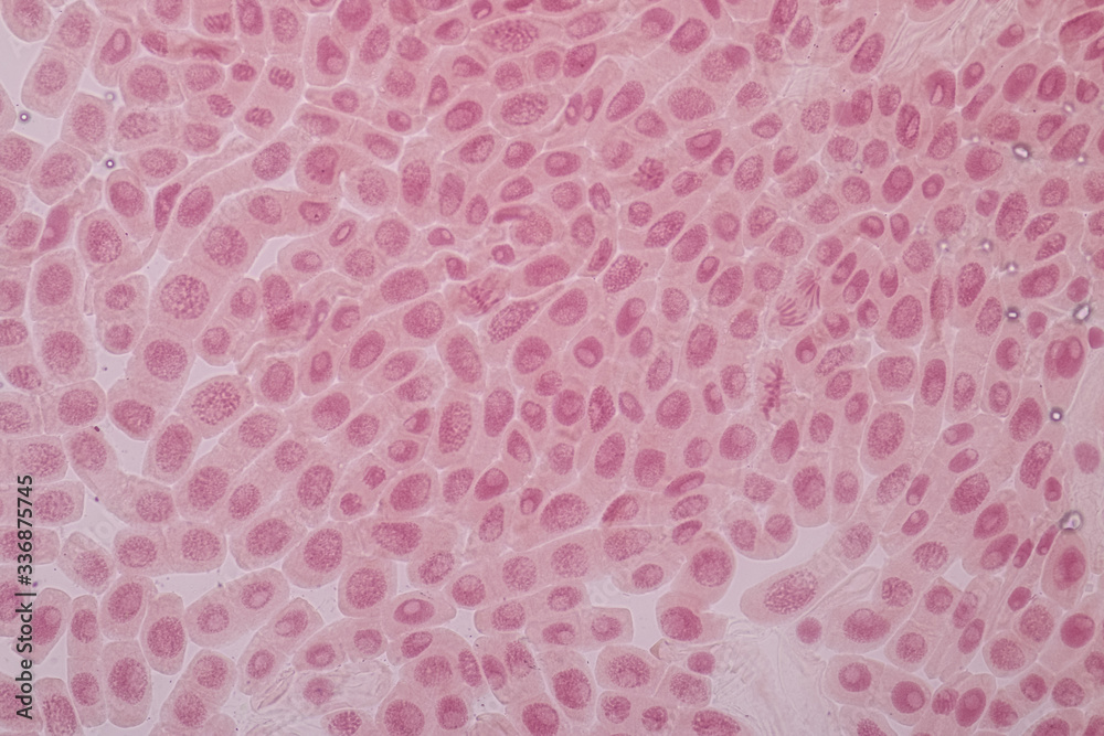 Root tip of Onion and Mitosis cell in the Root tip of Onion under a ...