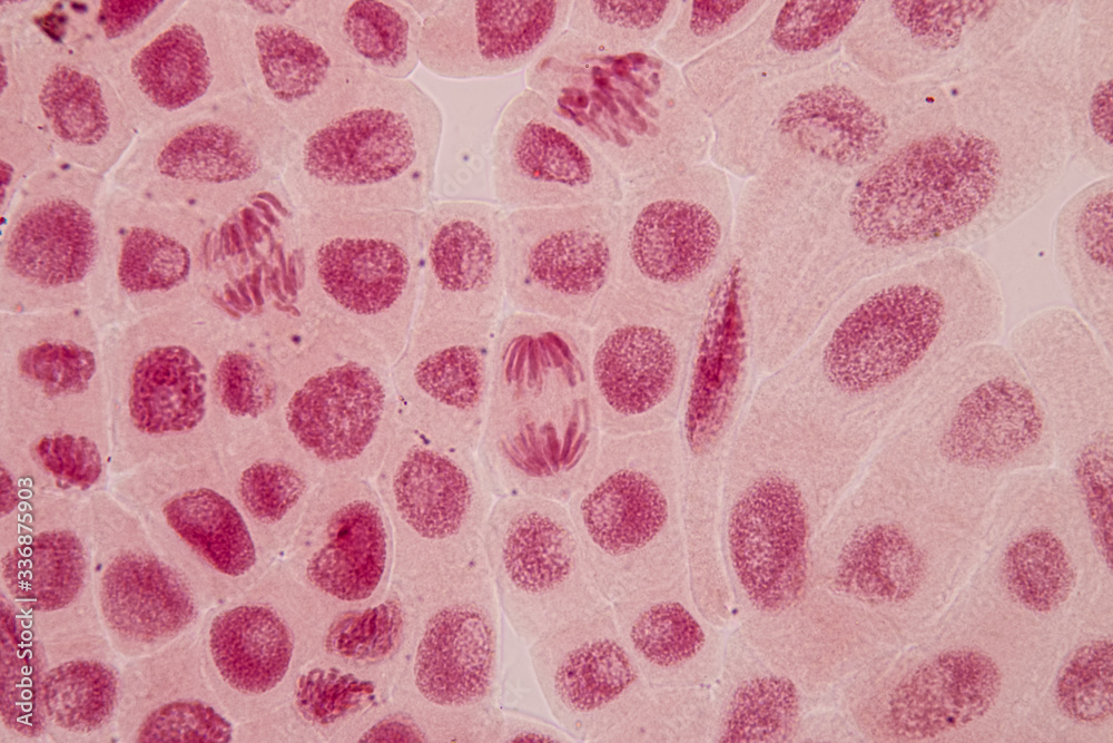 Root tip of Onion and Mitosis cell in the Root tip of Onion under a ...