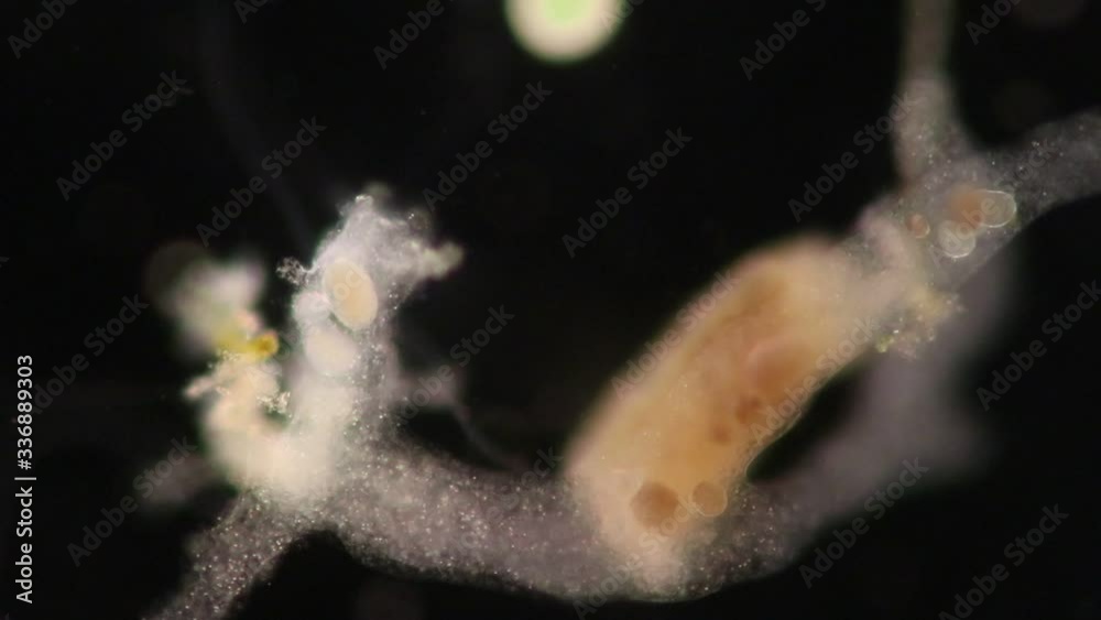 Vídeo do Stock: Amoebae move and feed by using pseudopods, which are ...