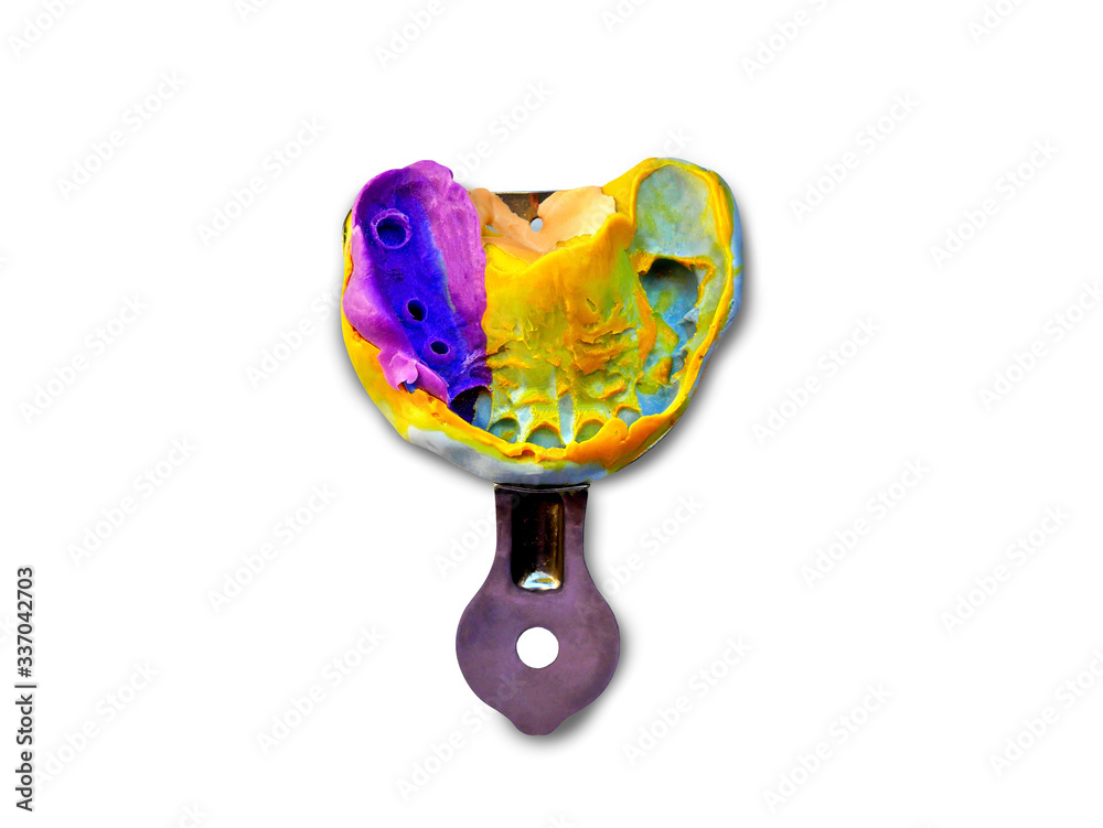 Dental spatula with print for dental implant. Dental spatula with an ...