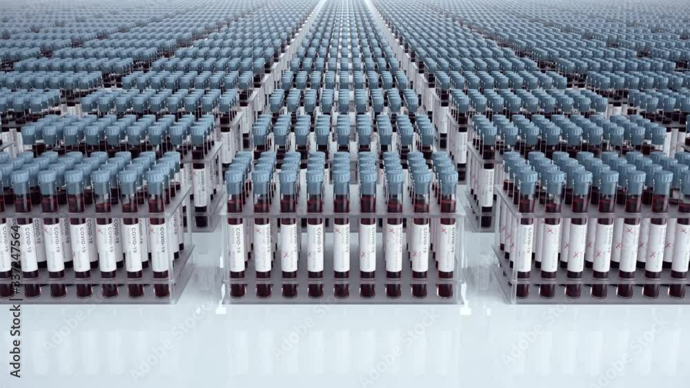 Coronavirus blood test tubes in a rows. Covid-19 test tubes. Negative ...