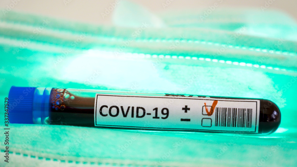 A positive of Covid-19 or coronavirus test sample Stock Photo | Adobe Stock