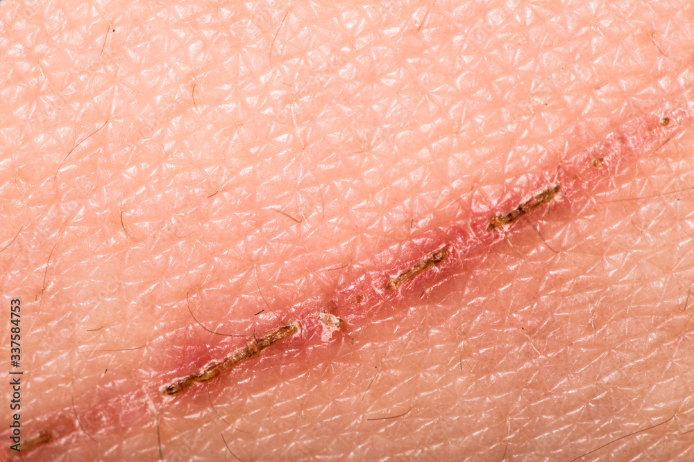 Texture of human skin and scratch Stock Photo | Adobe Stock