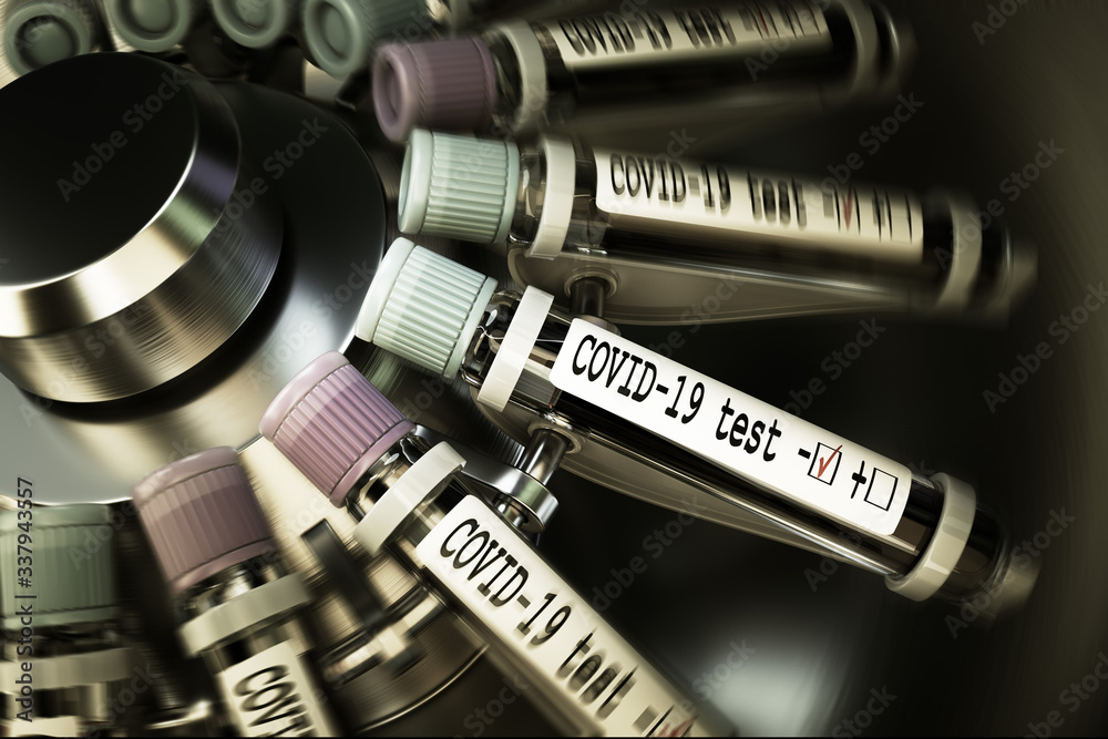 Vials of blood in a centrifuge. Negative COVID-19 test and laboratory ...