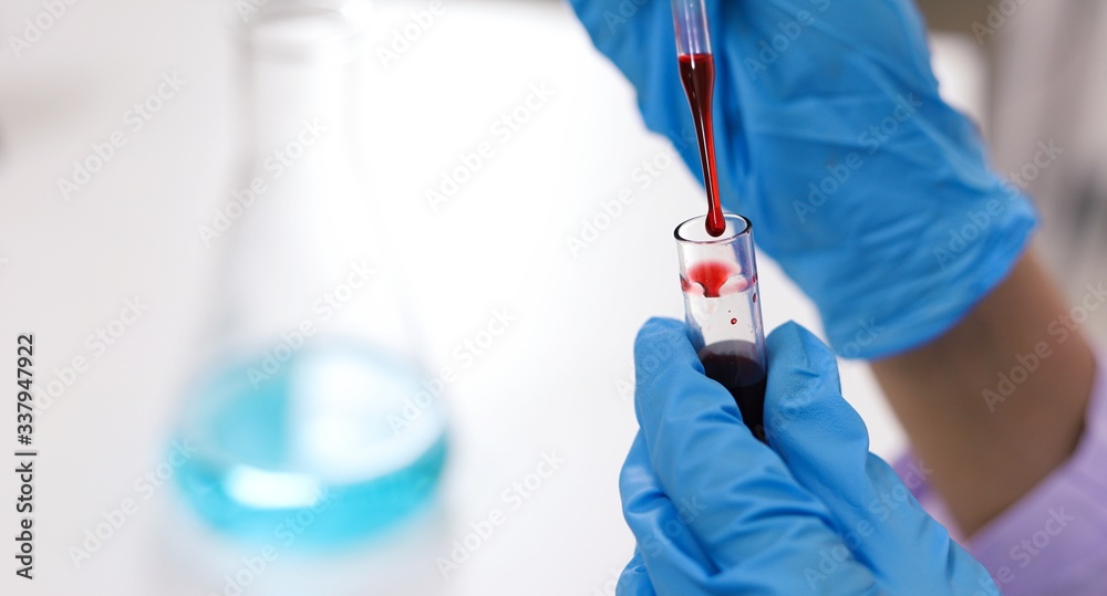 Scientist holding Coronavirus covid-19 infected blood sample tube DNA ...