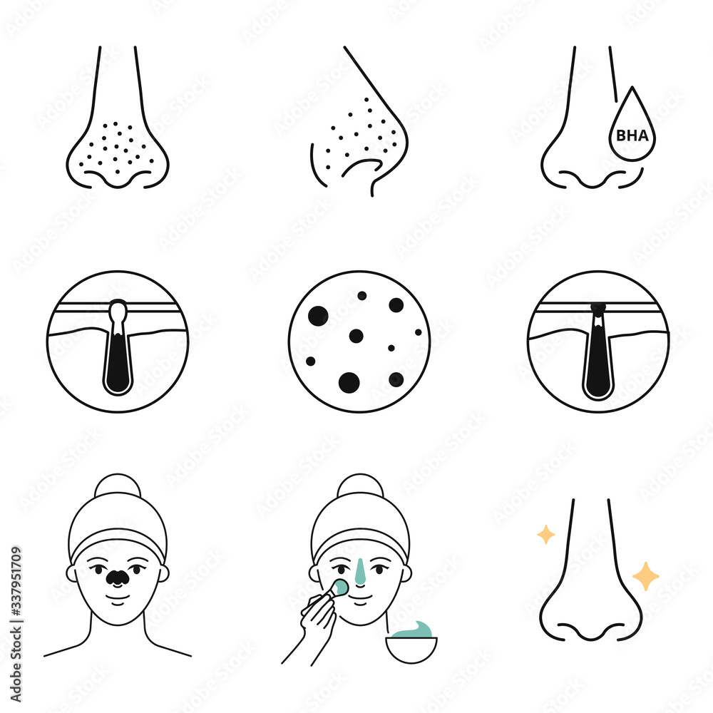 Enlarged pores treatment, blackheads vector icons set Stock Vector ...