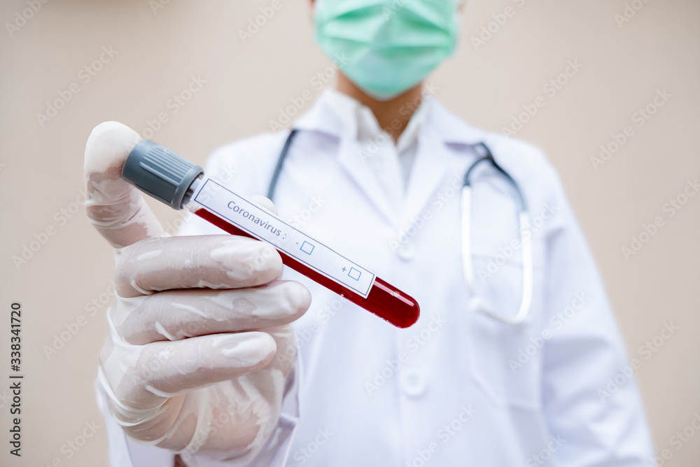 Professional doctors perform COVID-19 tests from samples of blood tests ...