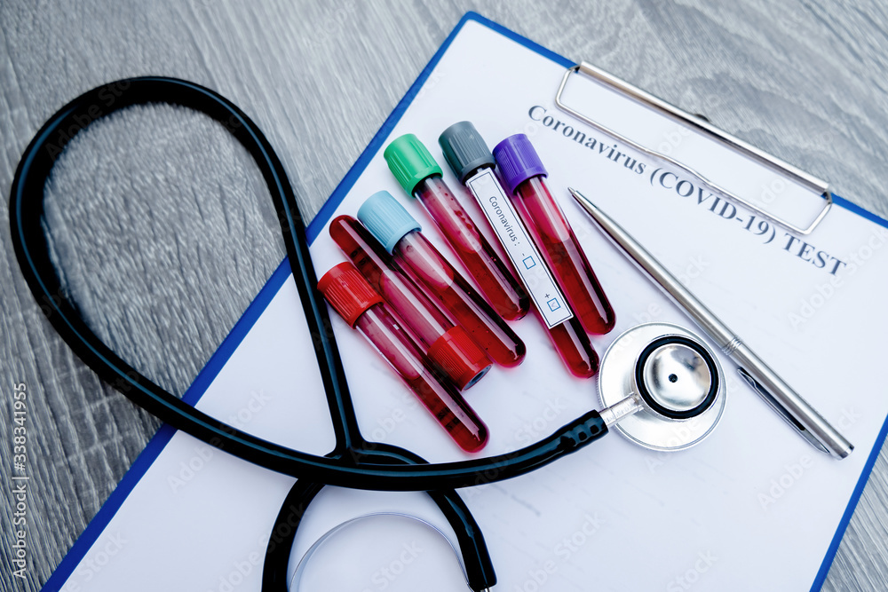 Professional doctors perform COVID-19 tests from samples of blood tests ...