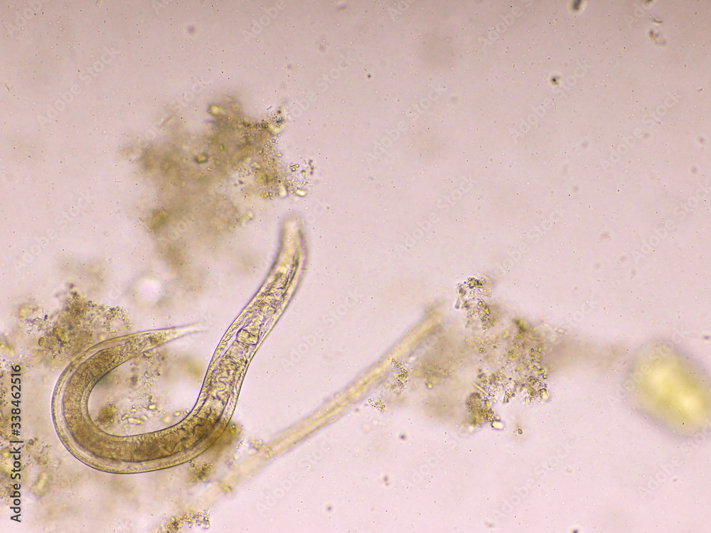 Strongyloides stercoralis or threadworm in human stool, analyze by ...