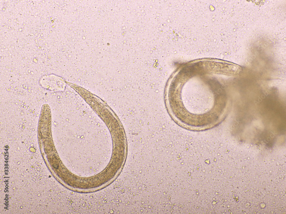 Strongyloides stercoralis or threadworm in human stool, analyze by ...