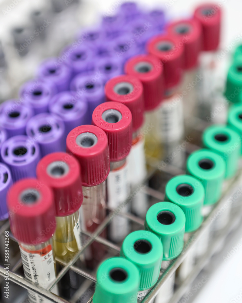 Blood collection tubes in a hospital lab Stock Photo | Adobe Stock
