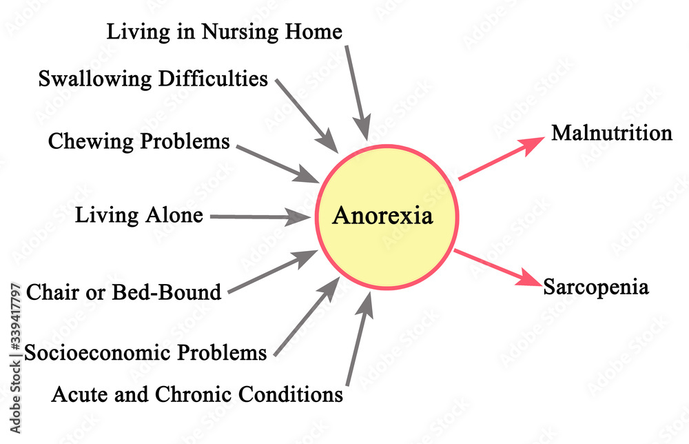 Anorexia: its causes and consequences Stock Illustration | Adobe Stock