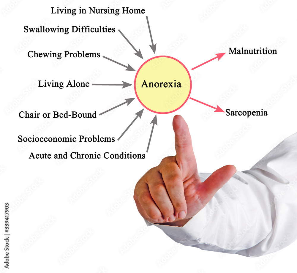Anorexia: its causes and consequences Stock Photo | Adobe Stock
