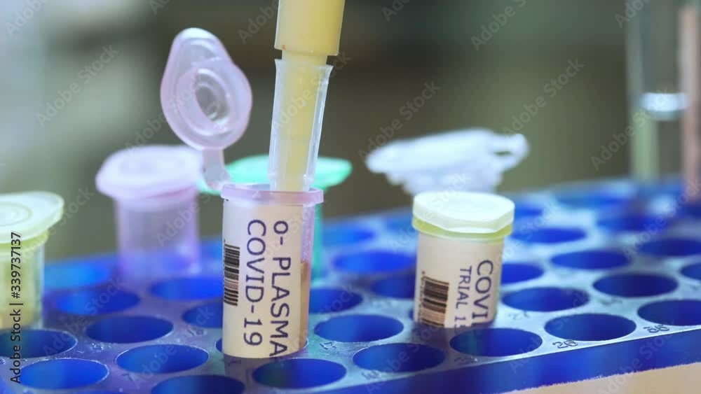 The tip of a pipette extracts serum from a small snap lock plastic vial ...