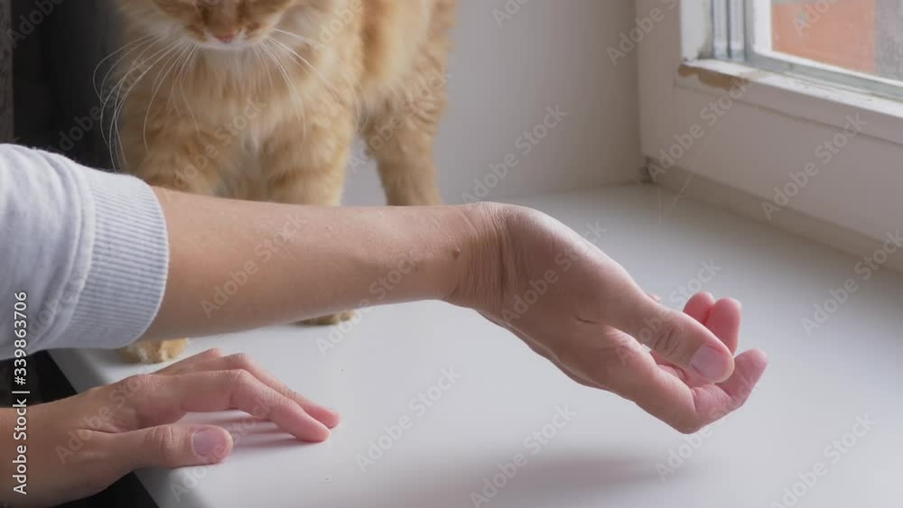 Woman shows scratches made by cute ginger cat. Fluffy pet lying on ...