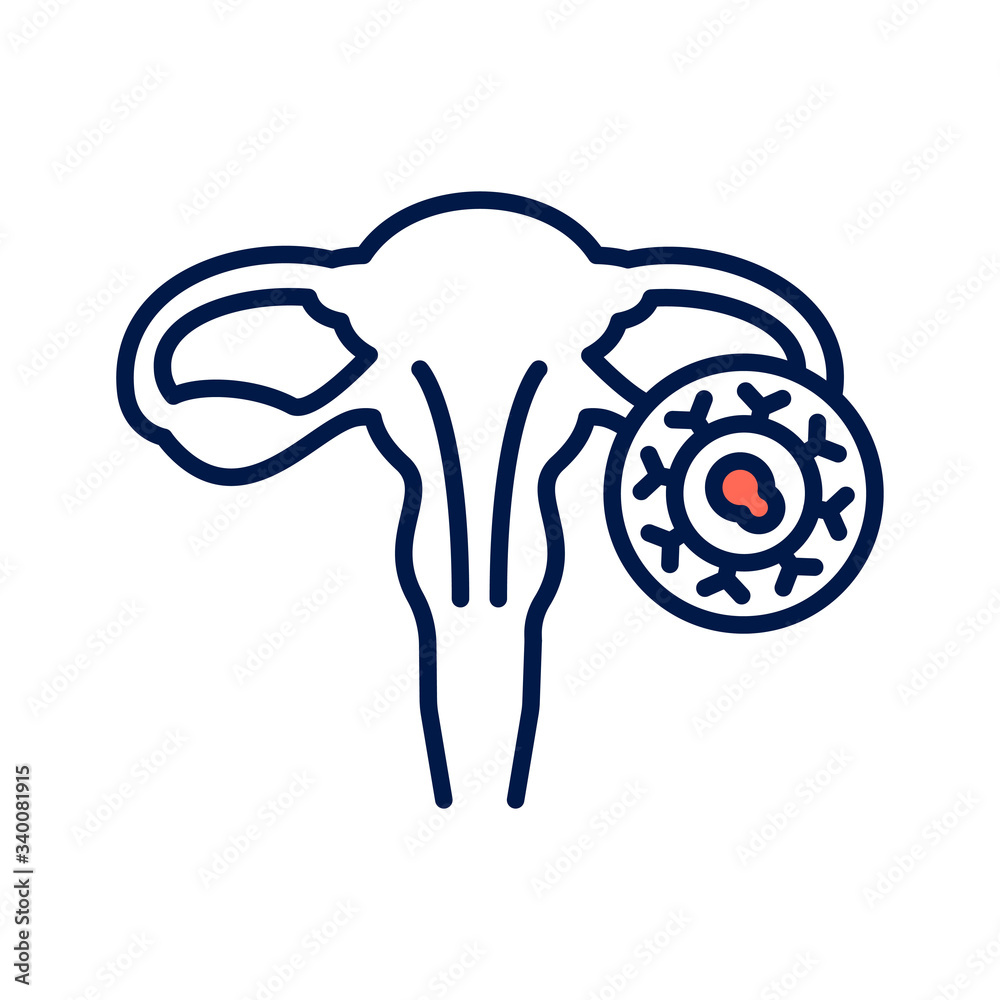 Cervical cancer line color icon. Malignant neoplasm. Female ...