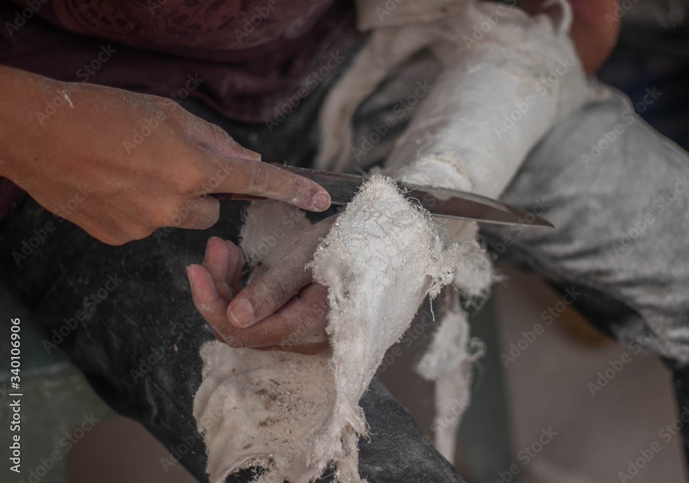 Boy removing and cutting a plaster cast and bandages at home from his ...