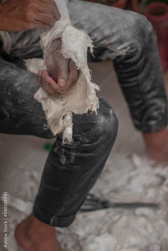 Boy removing and cutting a plaster cast and bandages at home from his ...