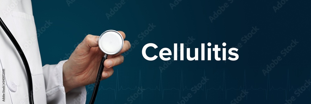 Cellulitis. Doctor in smock holds stethoscope. The word Cellulitis is ...