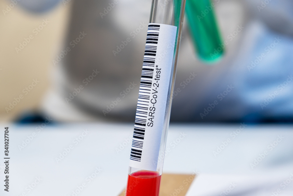 Test tube with SARS-CoV-2 in the hands, coronavirus COVID-19 Stock ...