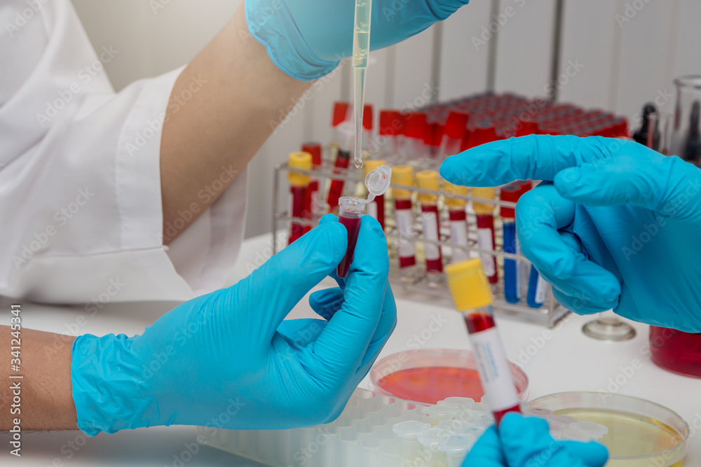 Sample of the vaccine covid-19 in the laboratory. Stock Photo | Adobe Stock