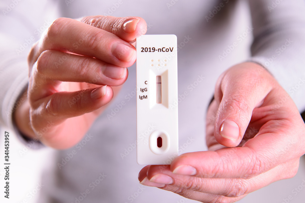 Rapid Covid-19 coronavirus strip test cassette for antibody or sars-cov ...