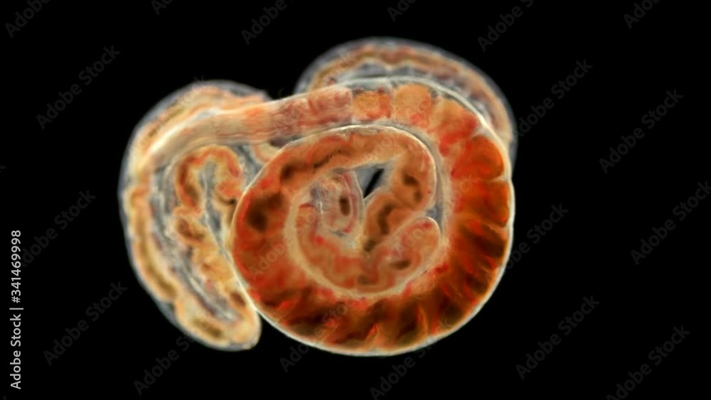 Tubifex worm under a microscope,Oligochaeta the Naididae family, type ...