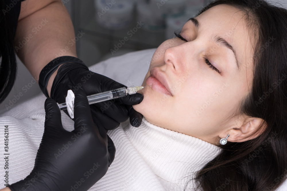 Injections of the lips. Adjustment of the lower lip form. Injection of ...
