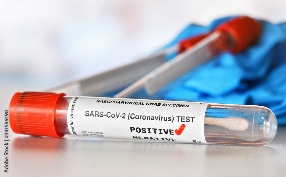 Coronavirus test concept - vial sample tube with cotton swab, red ...