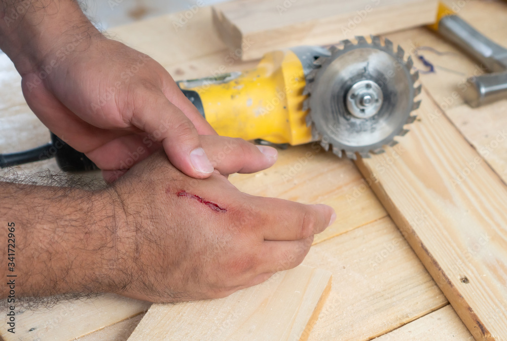 Fresh wound caused by saw blade ,fresh wound from accident while ...