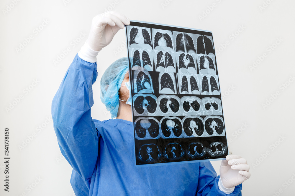 Lungs scan in Doctor hands. Surgeon in protective uniform check up MRI ...