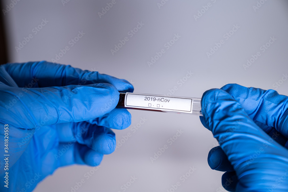 laboratory technician at work showing a sterile test tube containing a ...