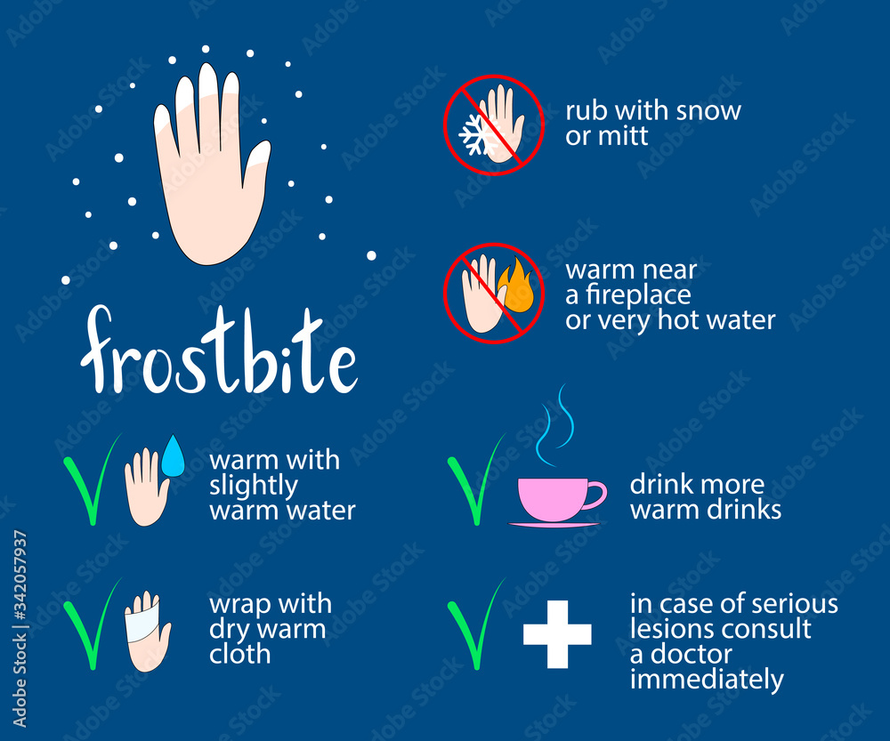 Frostbite infographics. First aid. What can and cannot be done with ...
