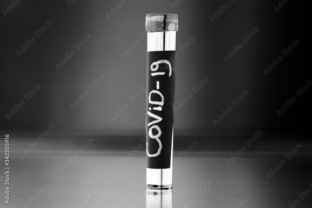 Test tube with blood of positive COVID-19 test and laboratory sample of ...