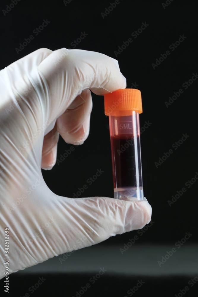 Blood sample bottle with specimen for laboratory testing Stock Photo ...