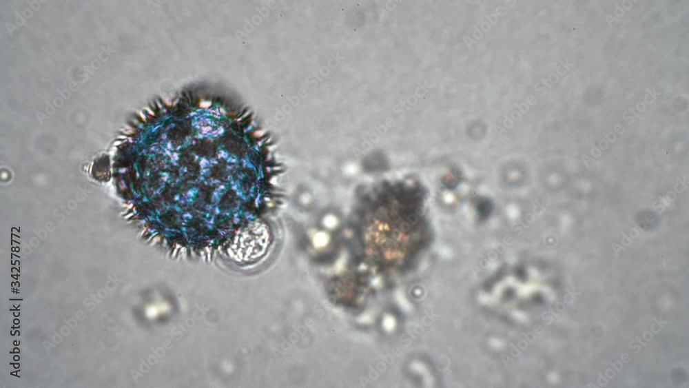 Round blue cell similar to a coronavirus covid-19 virus magnification ...