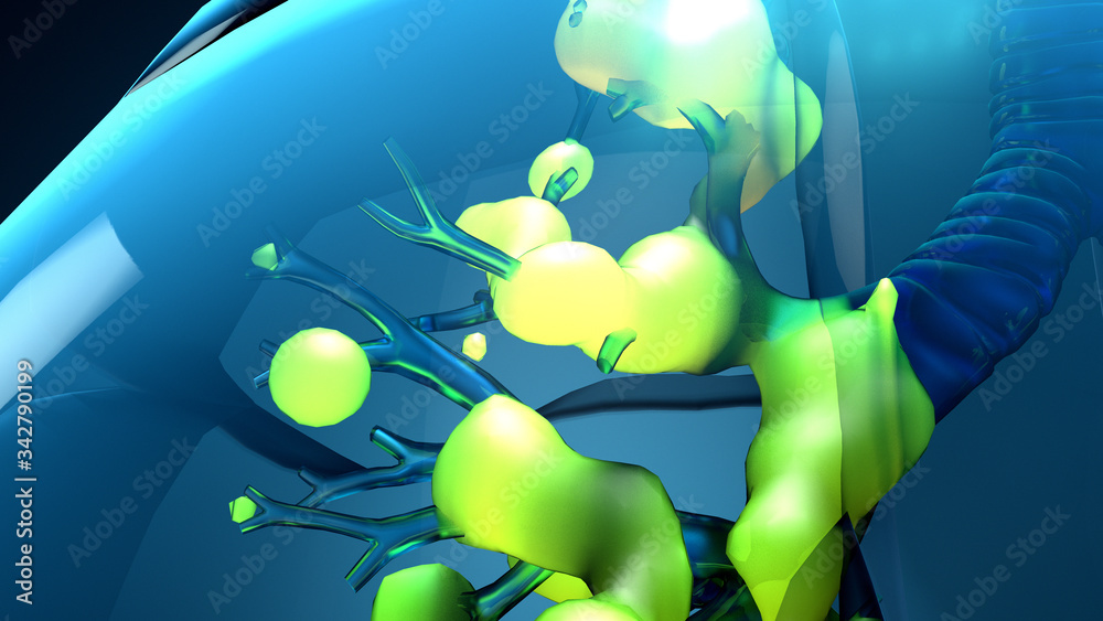 Damage lungs, severe respiratory illness, pneumonia, ARDS, acute ...