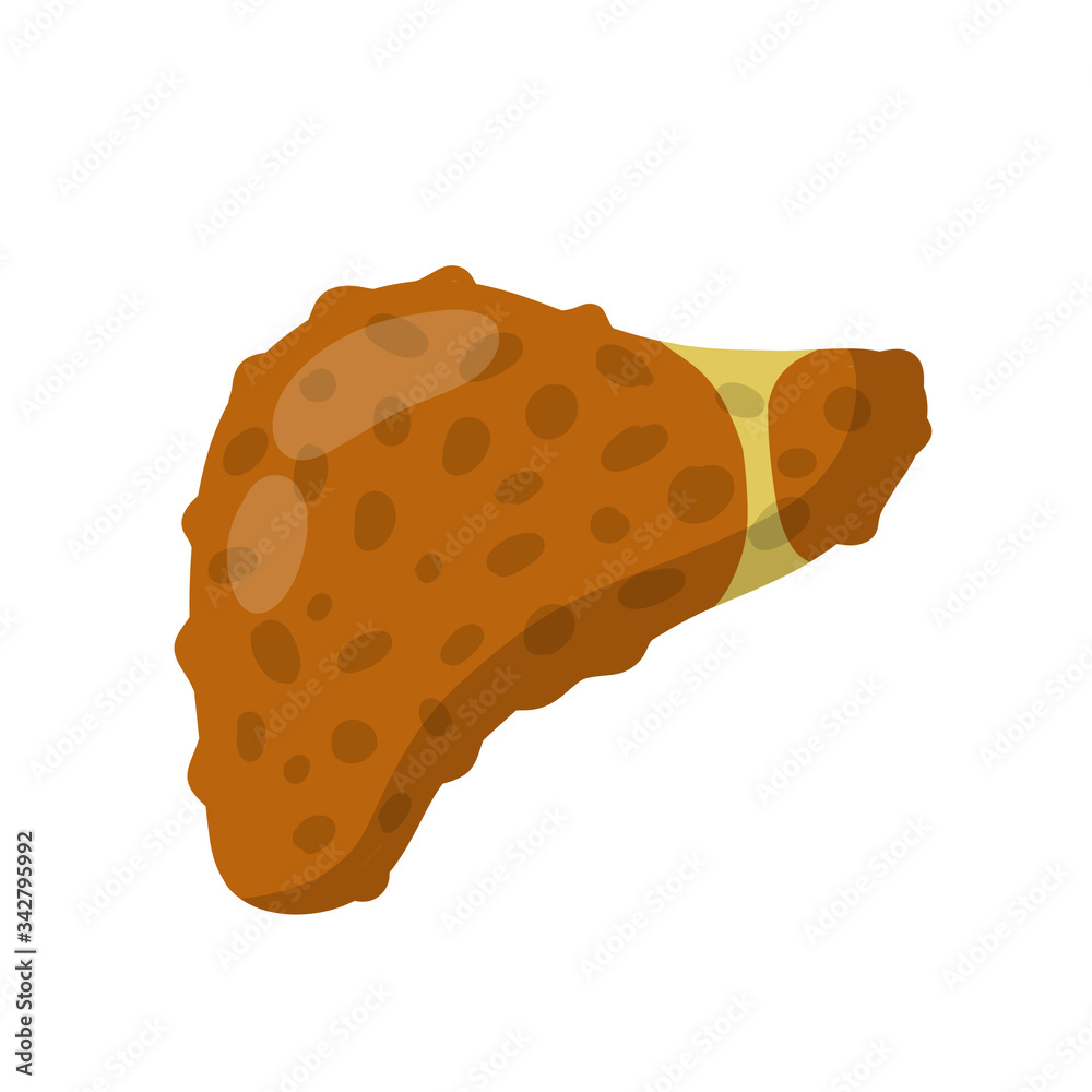 Bad liver. Medical Disease of human internal organ. Cartoon flat ...