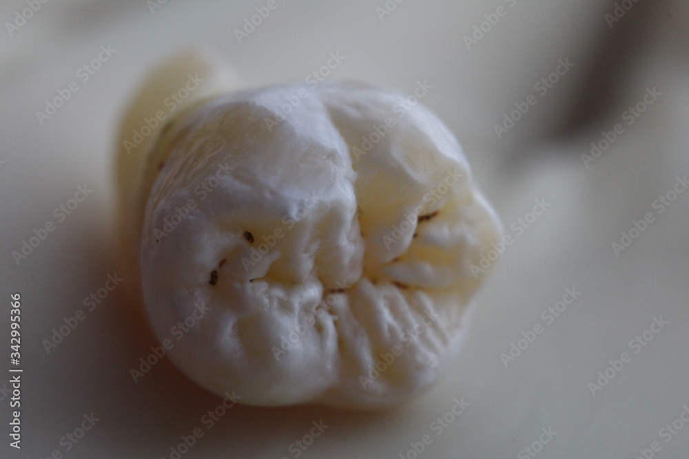 Póster Anatomía oclusal de la muela del juicio – Cuadro para Pared ...