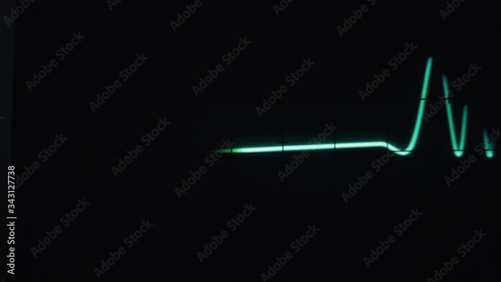 Sound Waveform (oscilloscope that measures voltage and intensity of the ...