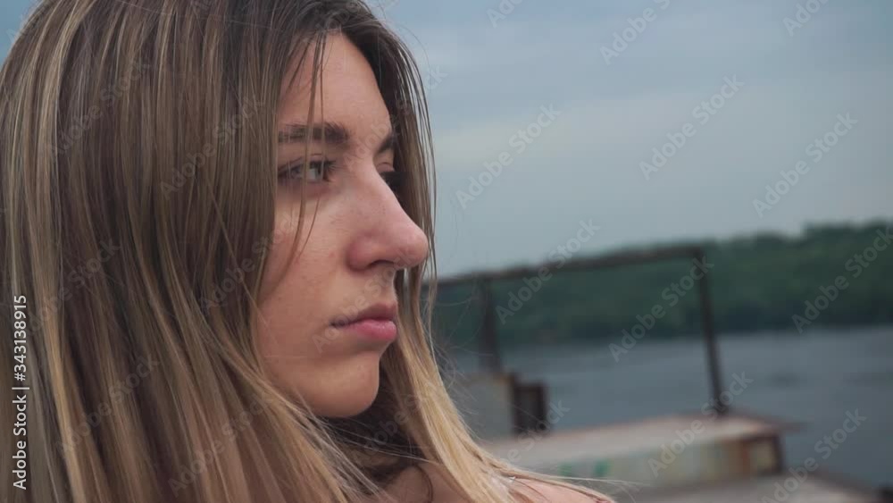 Vidéo Stock Close up portrait of a woman with bad skin, small acne ...